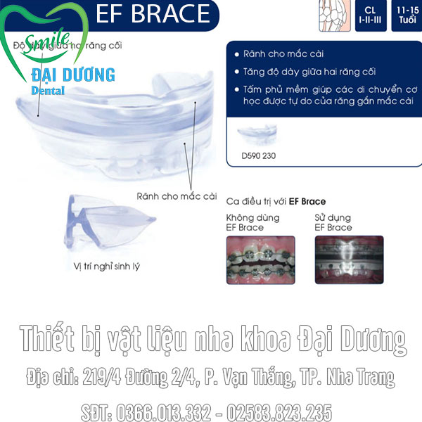 EF Braces (Đeo với chỉnh nha mắc cài, 11-15 tuổi, 2 hàm) - Đại Dương Center